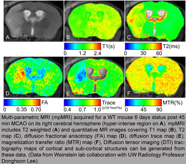 Weinstein Laboratory | Department of Neurology