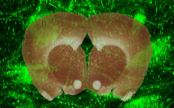 Pediatric Research – Department of Neurology